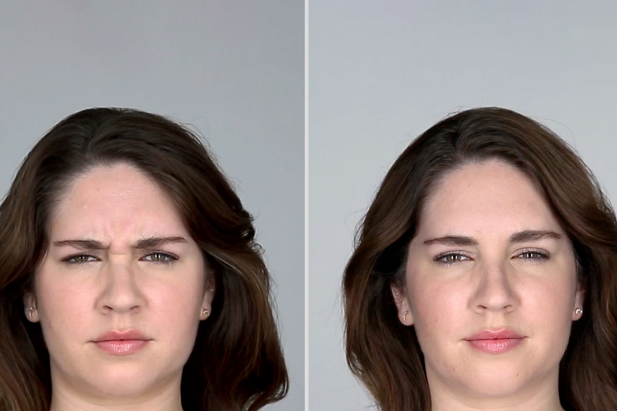 Botox in Golden, CO | Golden Laser Aesthetics